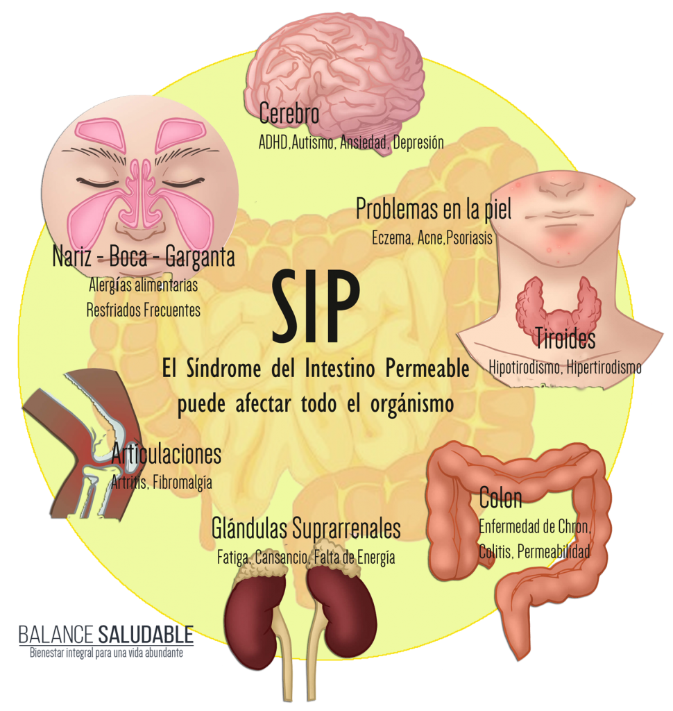 Síntomas del Intestino Permeable